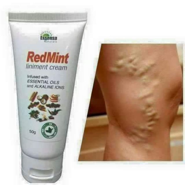 Redmint Liniment CreamFus | Lazada PH