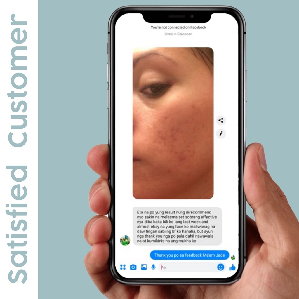 Divinei Original COSMIC Melasma Remover Set Face Skin Care Tools ...