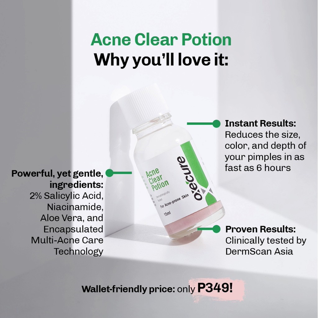 OXECURE Acne Clear Potion Bundle of 2 | Lazada PH