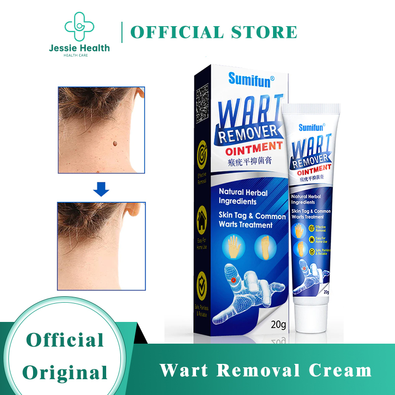 Jessie. Wart removal ointment, flat warts, filiform warts, common warts ...