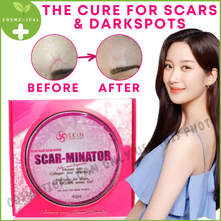 Original Skin Sensation Scar Minator Cream 50ml Scar Removing Cream ...