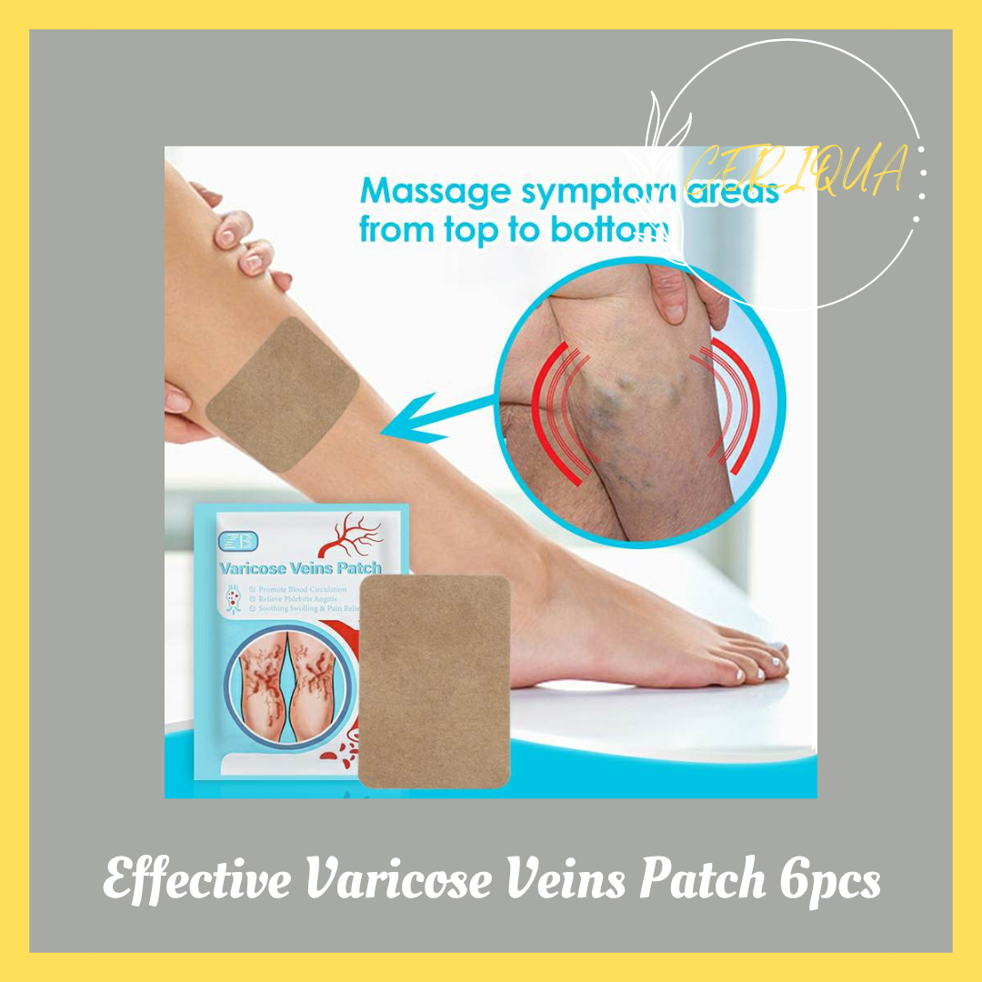 Varicose Veins Patch Varicose Veins Remover Effective Original Varicose ...