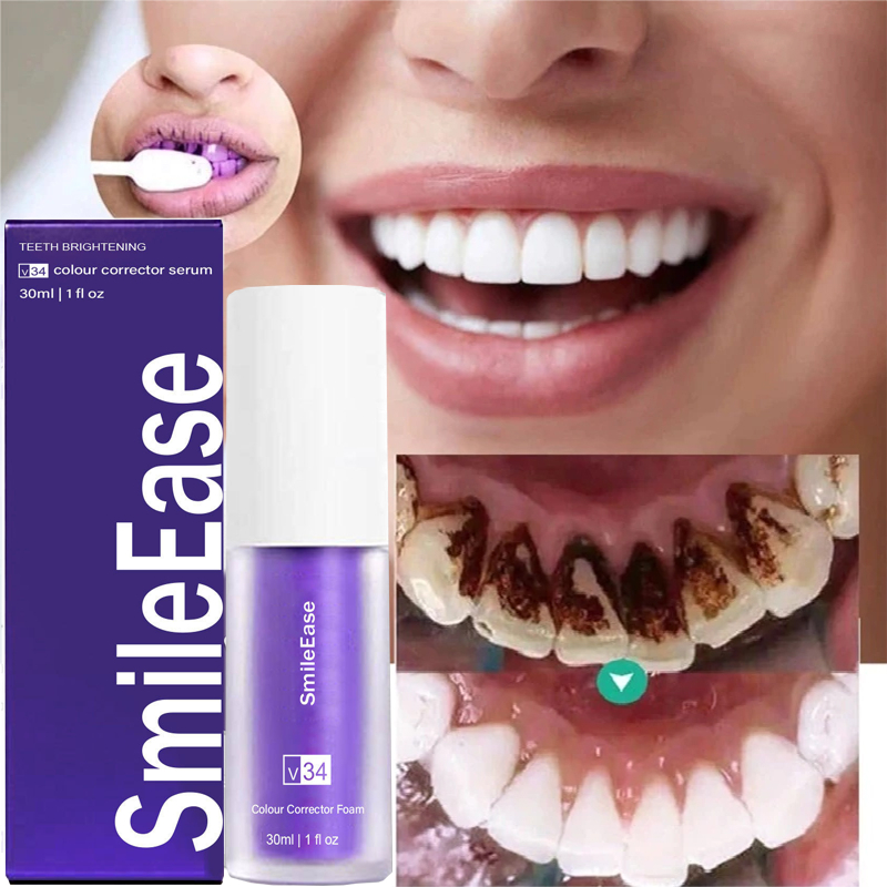 Smile Ease Toothpaste V34 Purple Teeth Whitening Toothpaste Mousse Foam ...