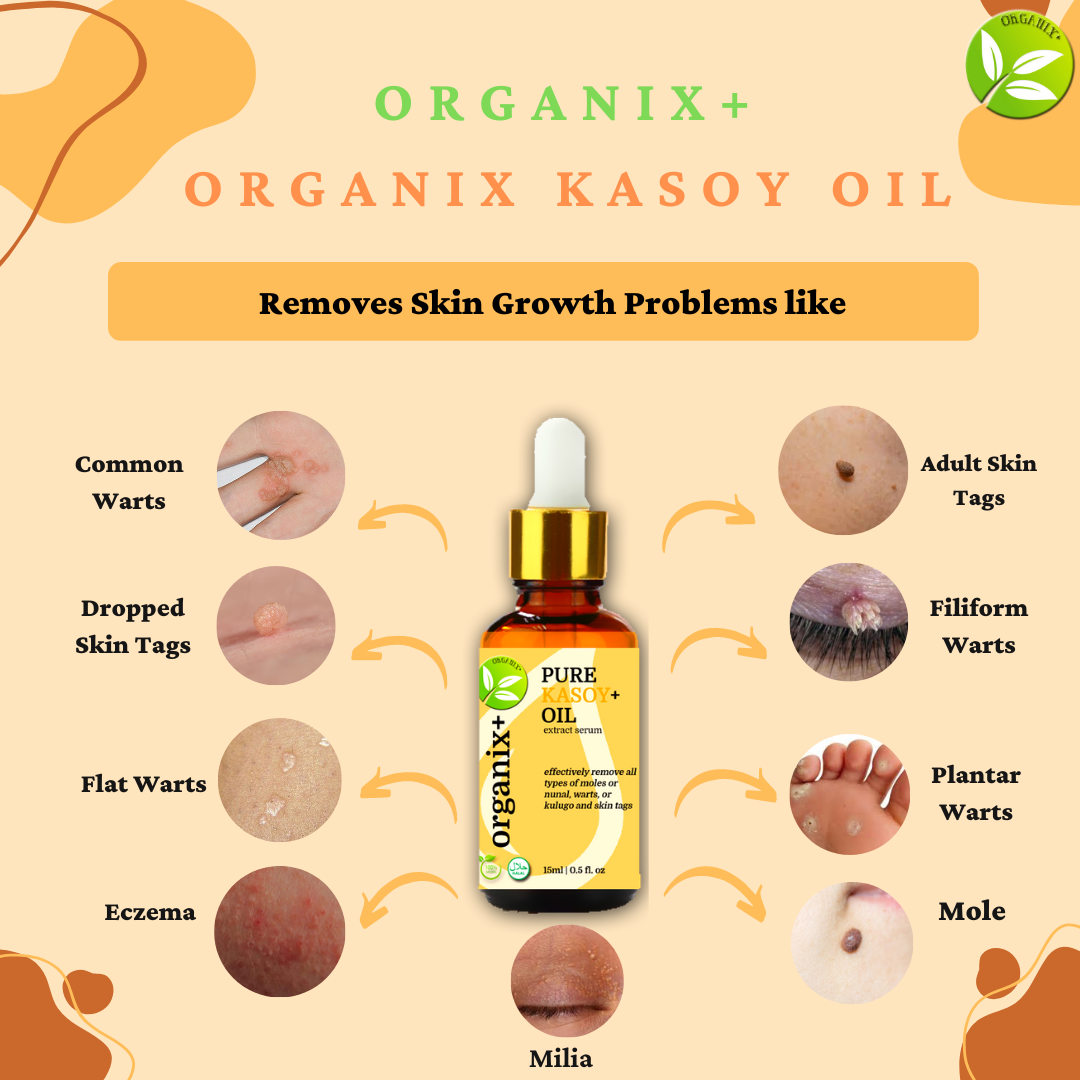 Organix+ - Original Organic Pure Cashew Oil for Warts, Skin Tags ...