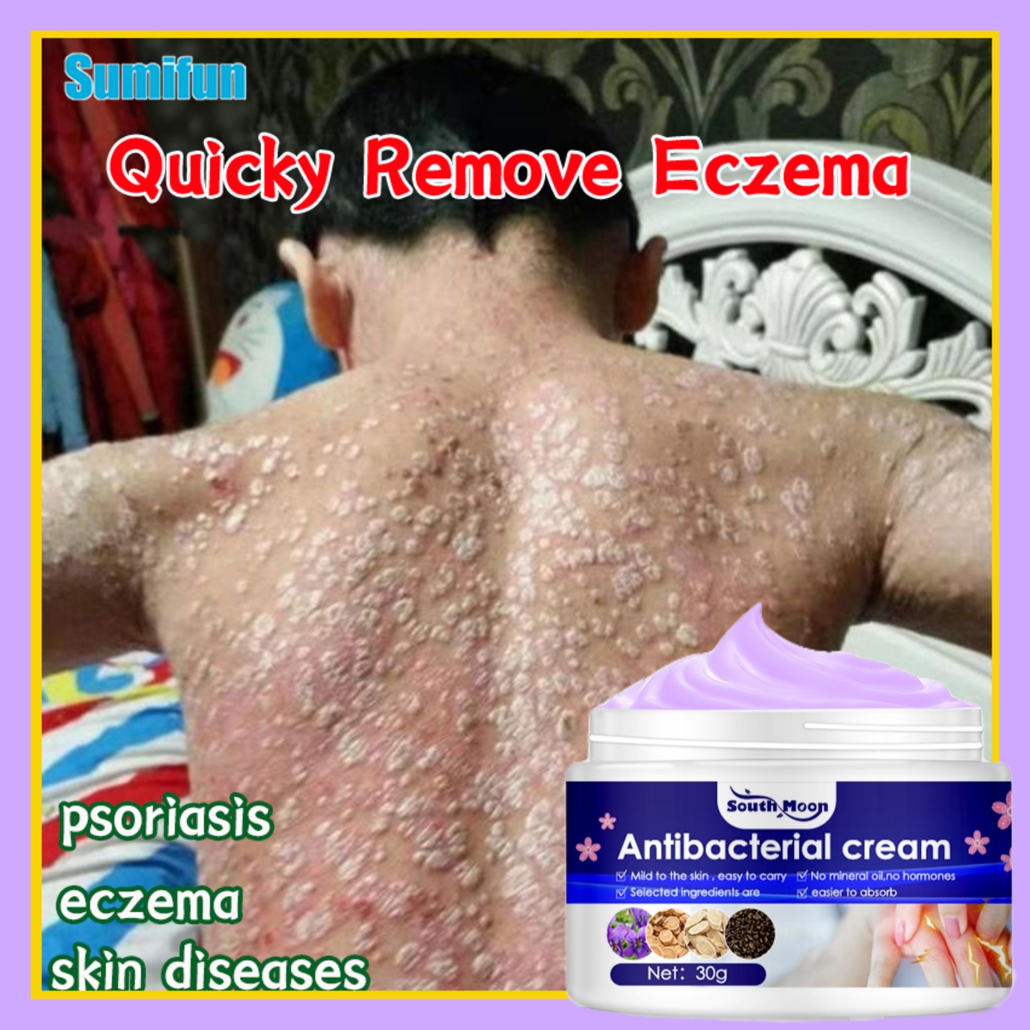 【Gamot Sa Kati Kati】Atoderma Cream Original Gamot sa kati kati sa balat ...