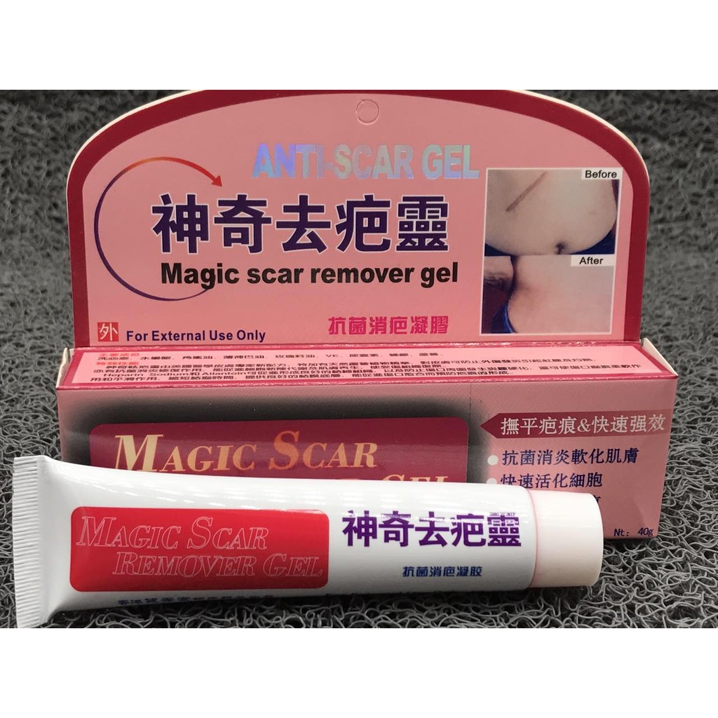 ANTI-SCAR GEL MAGIC SCAR REMOVER GEL RED | Lazada PH