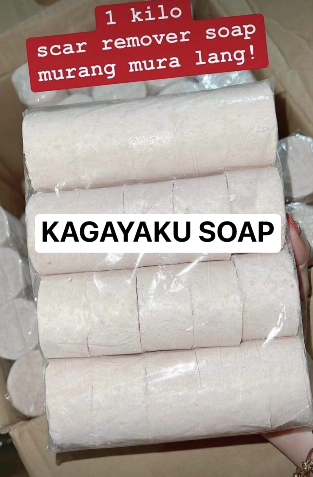 BRANDED KAGAYAKU SOAP ROUNDED SOAP SCAR REMOVER SOAP 1 KILO | Lazada PH