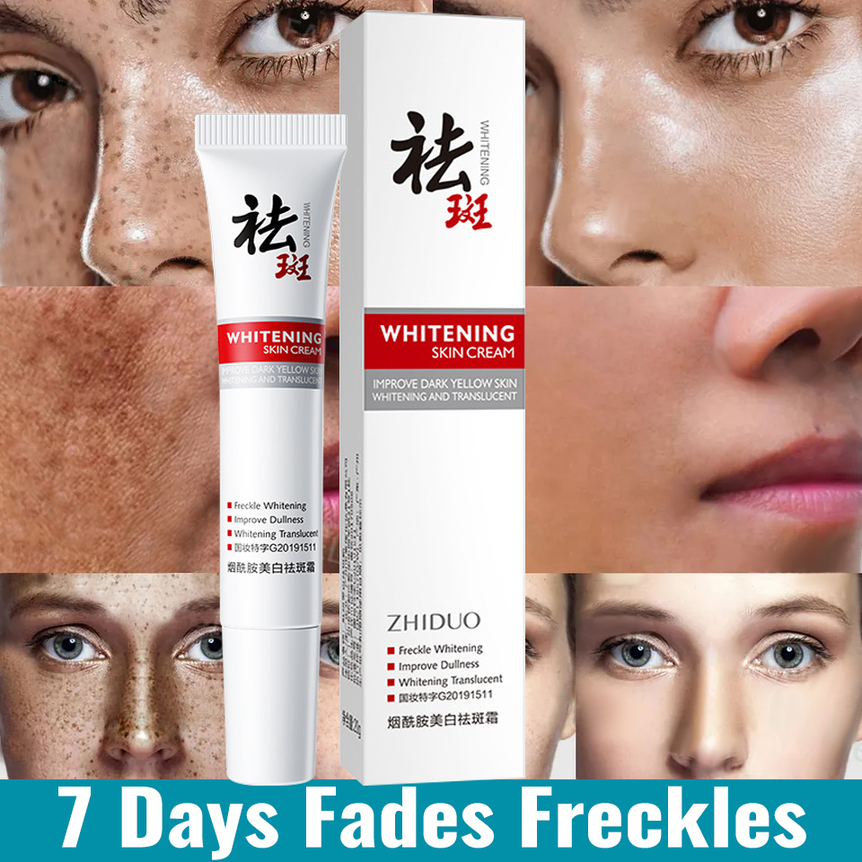 Fast effective freckle removal whitening cream retinol serum for face ...
