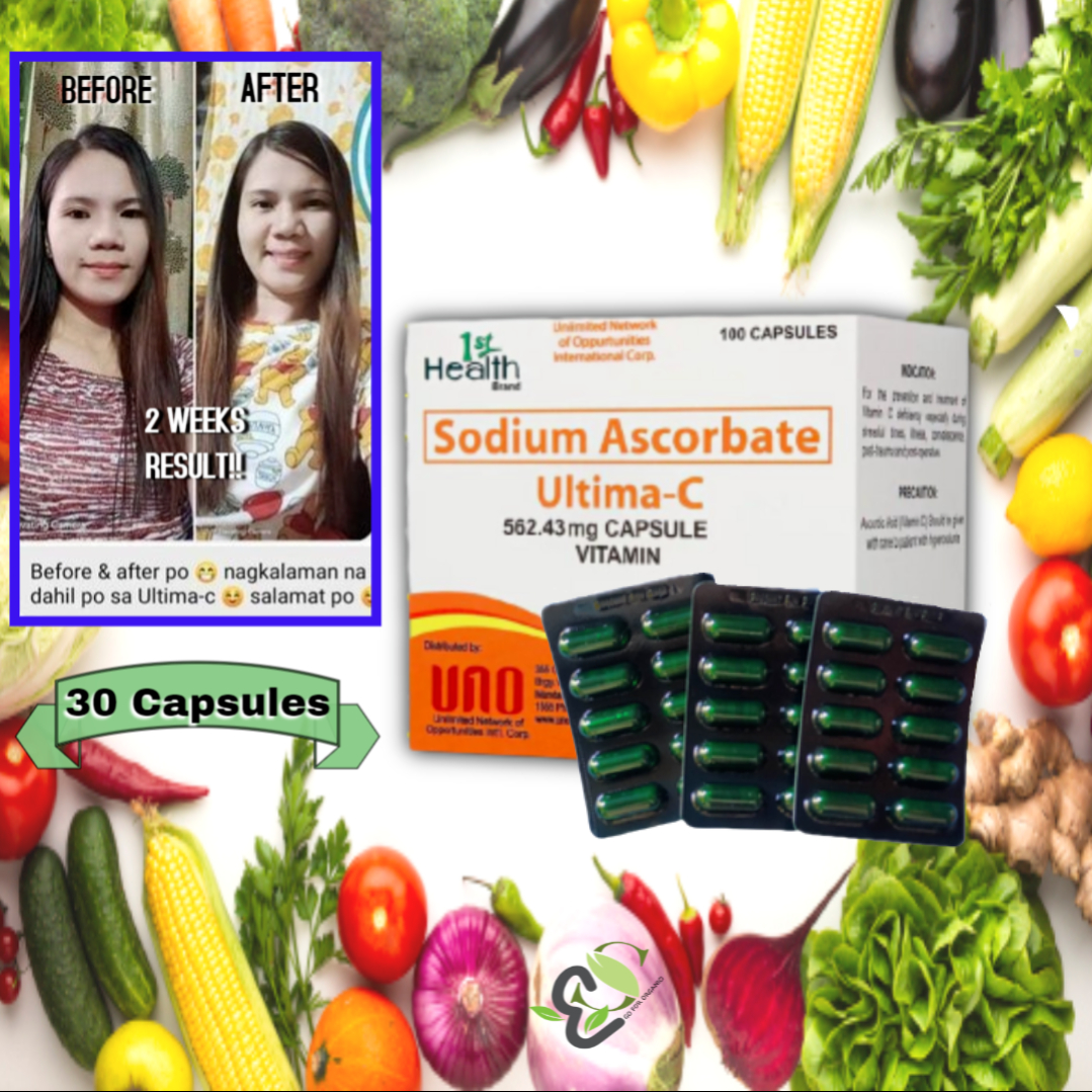Ultima C 30capsules pampataba na vitamins, sodium ascorbate, alkaline c ...