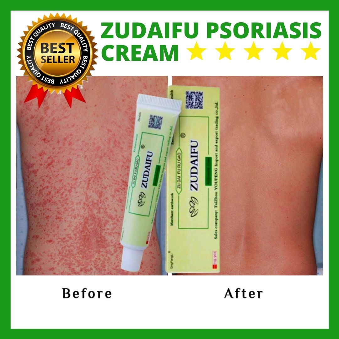 ⚡Premium Lifestyle PH | Zudaifu Miracle Skin Herbal Psoriasis Dermatitis Eczema Pruritus Cream ...