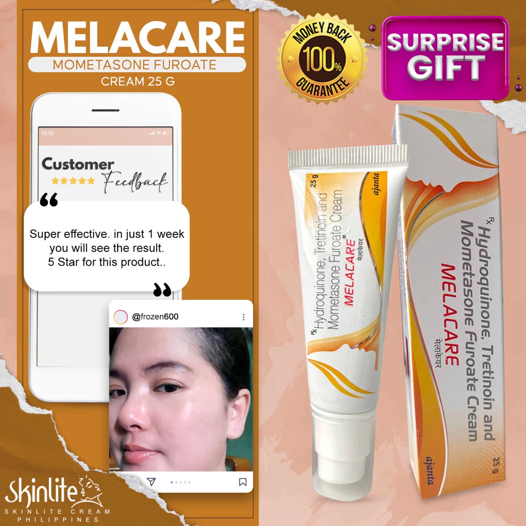 Melacare Cream Melasma Cream Original Pekas Eraser Melasma Remover 25g ...