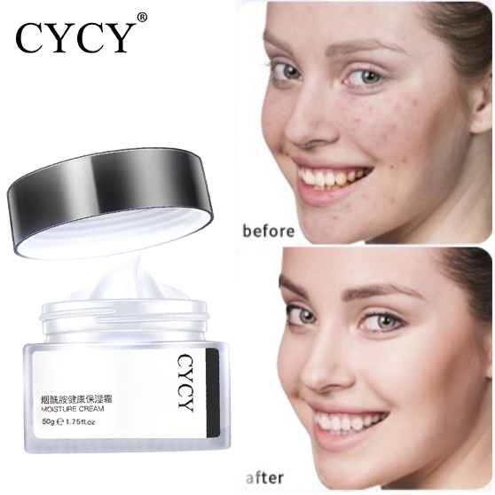 CYCY Niacinamide moisturizing cream revitalizing deep face cream 50g ...