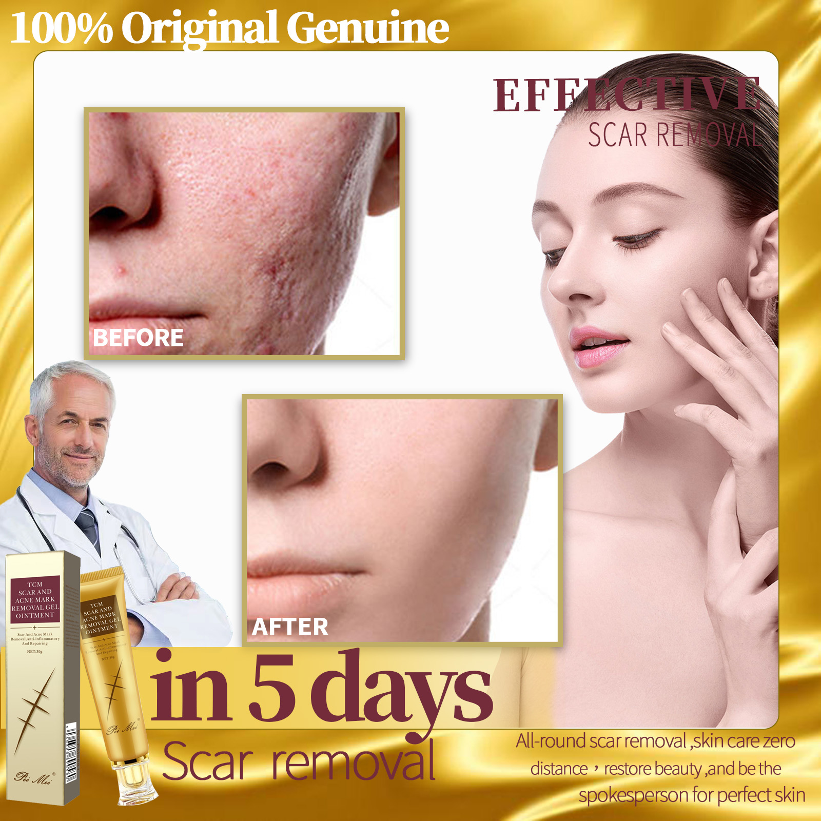 Keloids Scar Remover for old scar on leg fix Scar Removal Cream ...