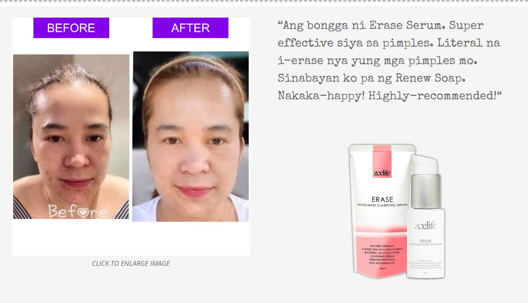 ERASE SERUM | Lazada PH