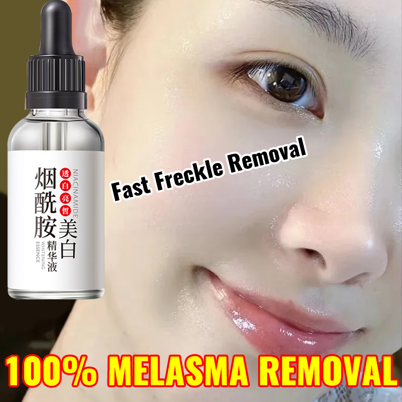 melasma and pekas remover serum, melasma removal cream original ...