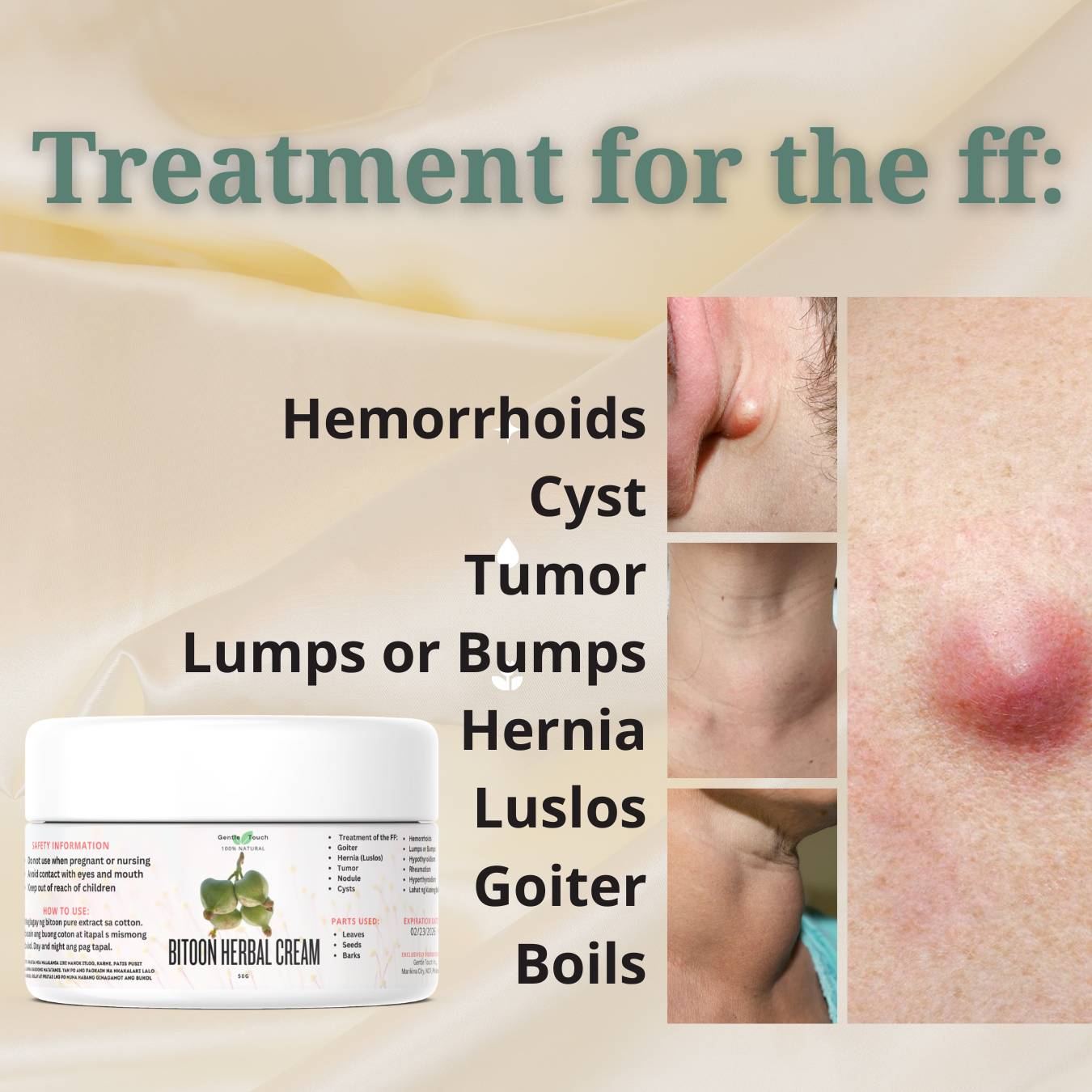 BITOON CREAM Lipoma Removal Cream 20G Lipoma Removal Cream Original ...