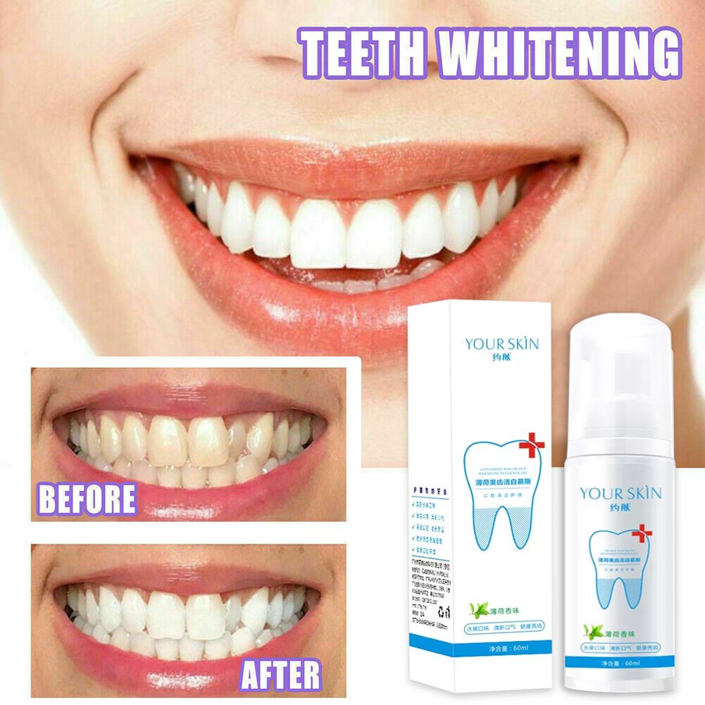 Teeth Whitening Mousse Toothpaste Oral Hygiene Remove Stains Plaque ...