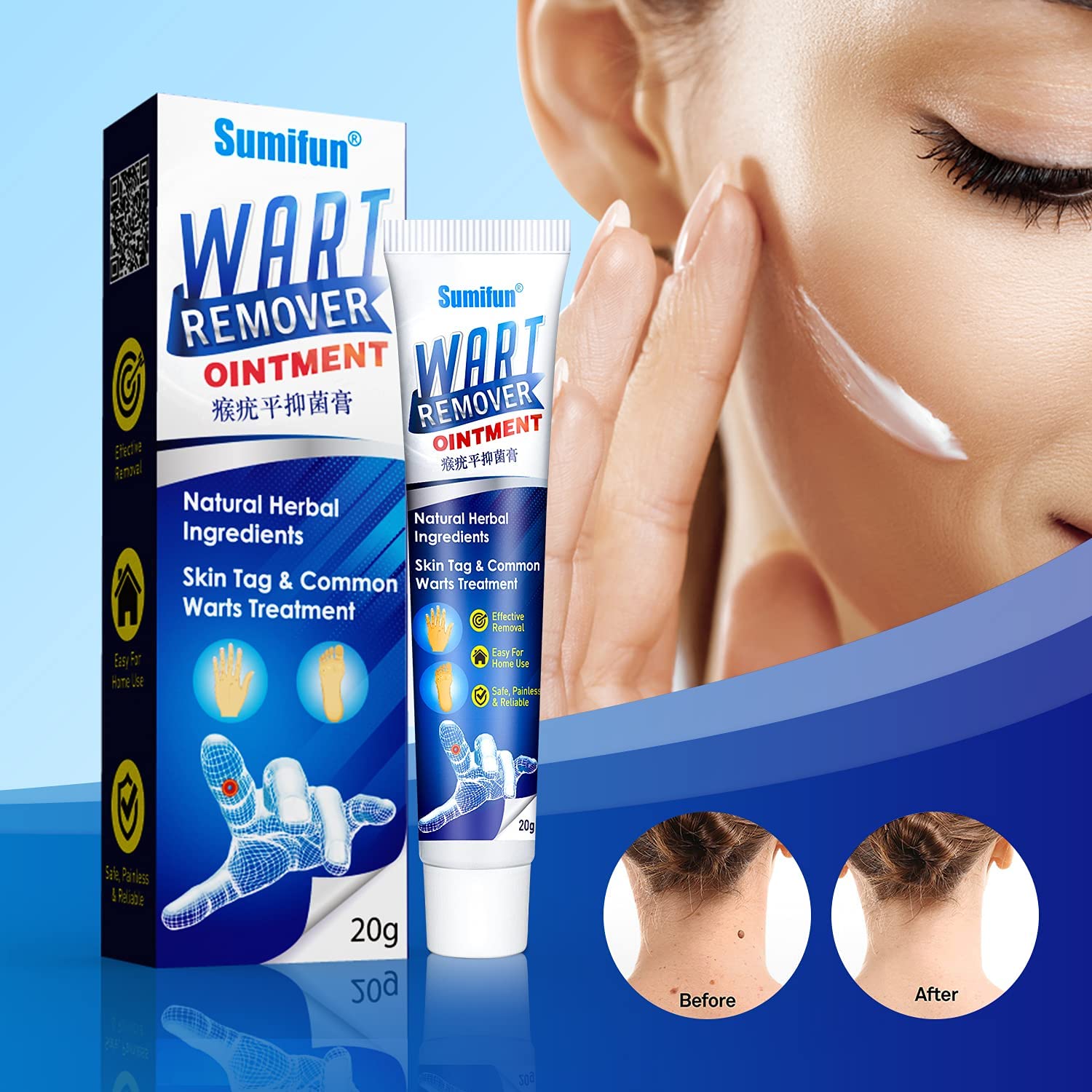 Wart Remover Ointment Wart Treatment Cream Skin Tag Remover Herbal ...