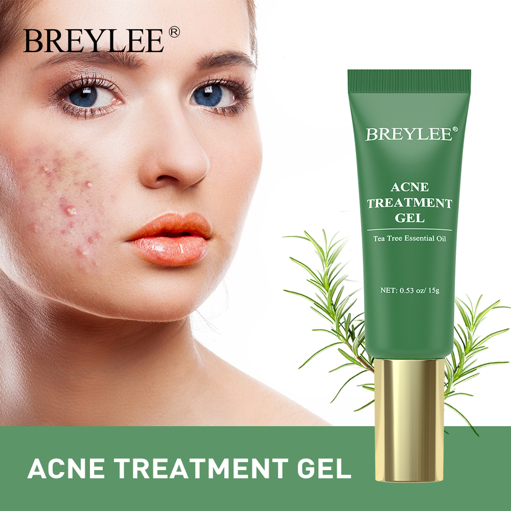 BREYLEE Acne Treatment Serum Gel 15g Anti Acne Facial Cream Skin Care | Lazada PH