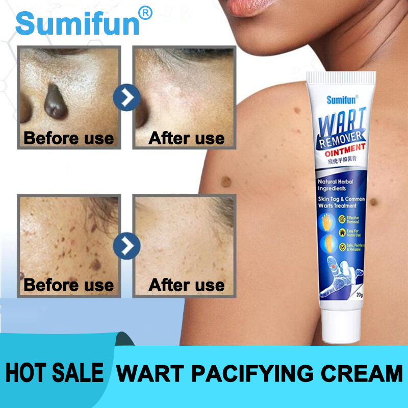SUMIFUN Warts Remover Original Cream Ointment Painless removal of ...