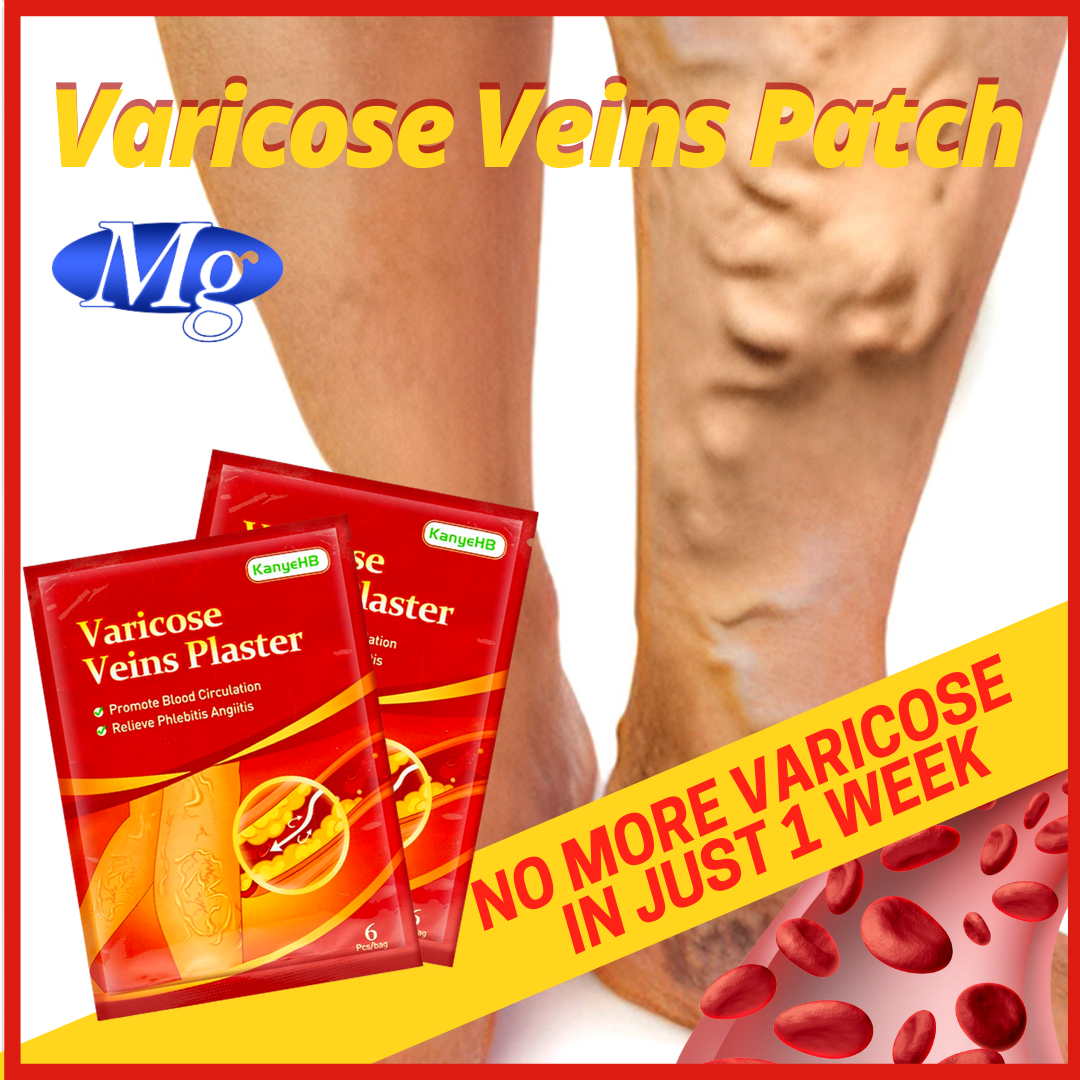 [ MAGNESIUM PH ] VARICOSE VEINS PLASTER | Varicose Veins Pain Relief ...