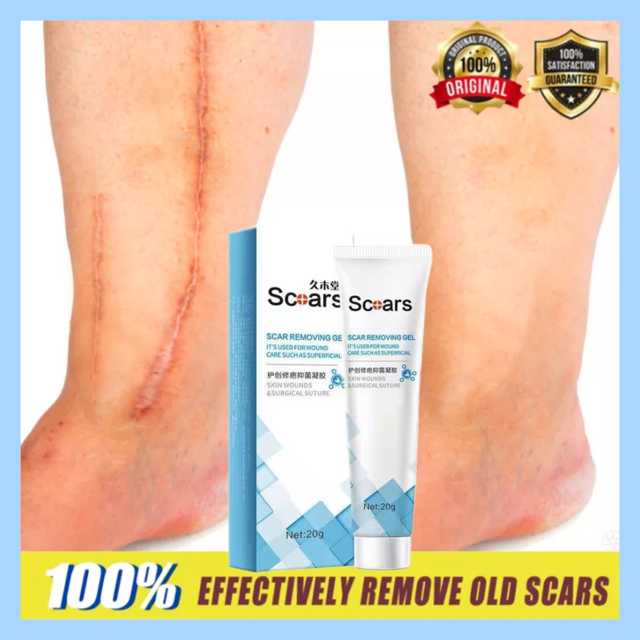 scar remover for old scar on leg fix scar strechmark removal original ...