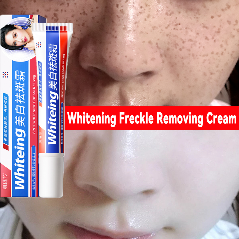pekas remover cream original melasma remover cream 20g original cream ...