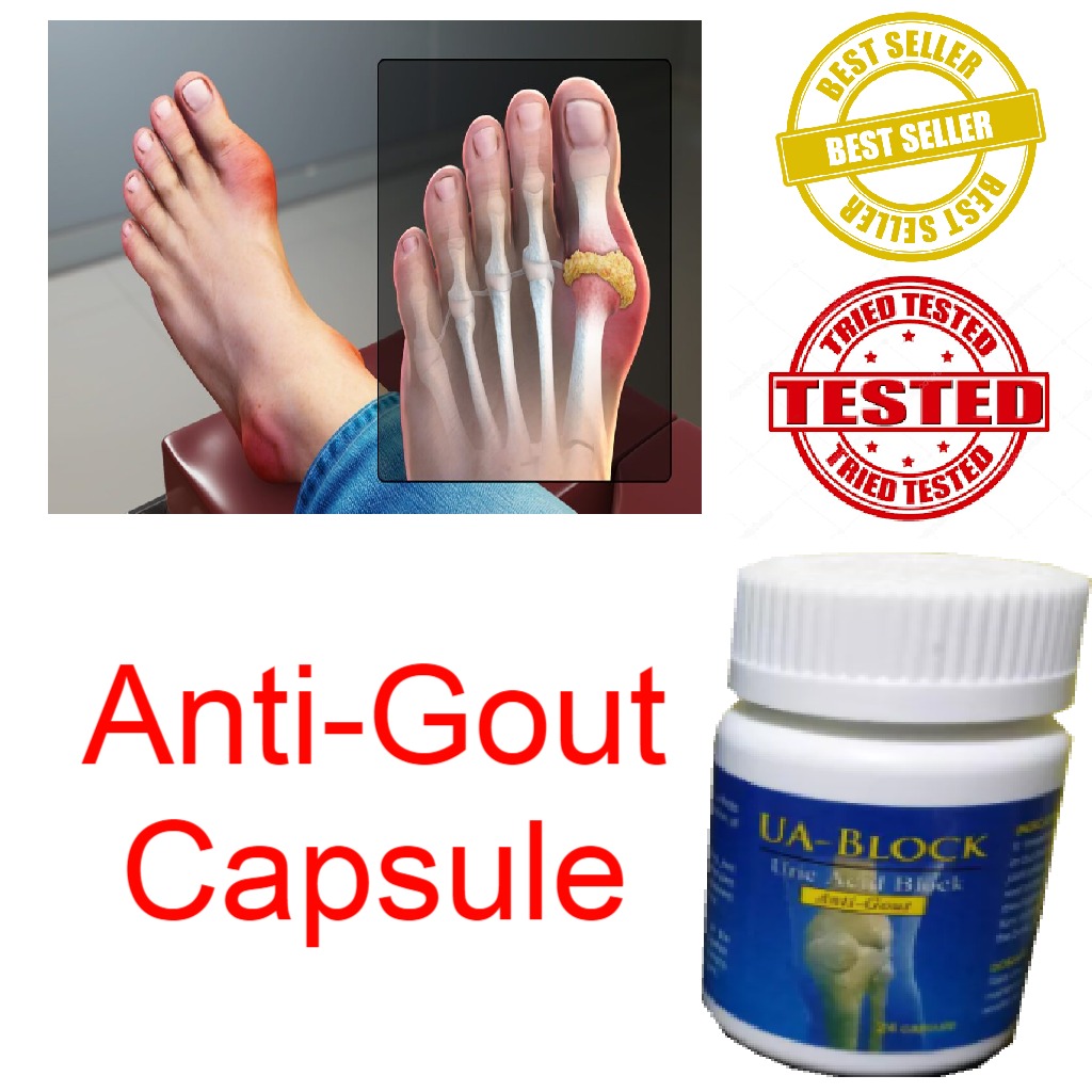 original 100% UA Block Uric Acid Block Anti Gout 24’S | Health ...