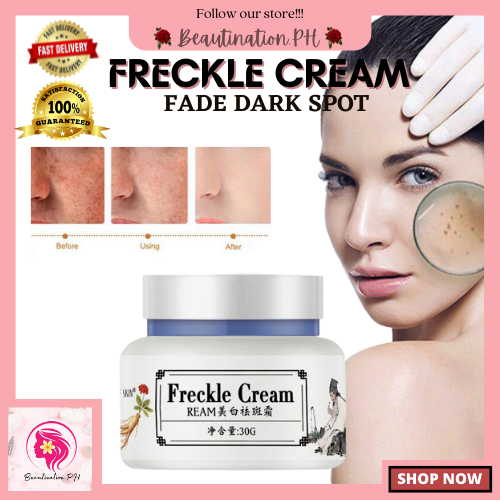 Freckle Removing Cream Sunburn Women Fade Spots, Whiten and Brighten ...