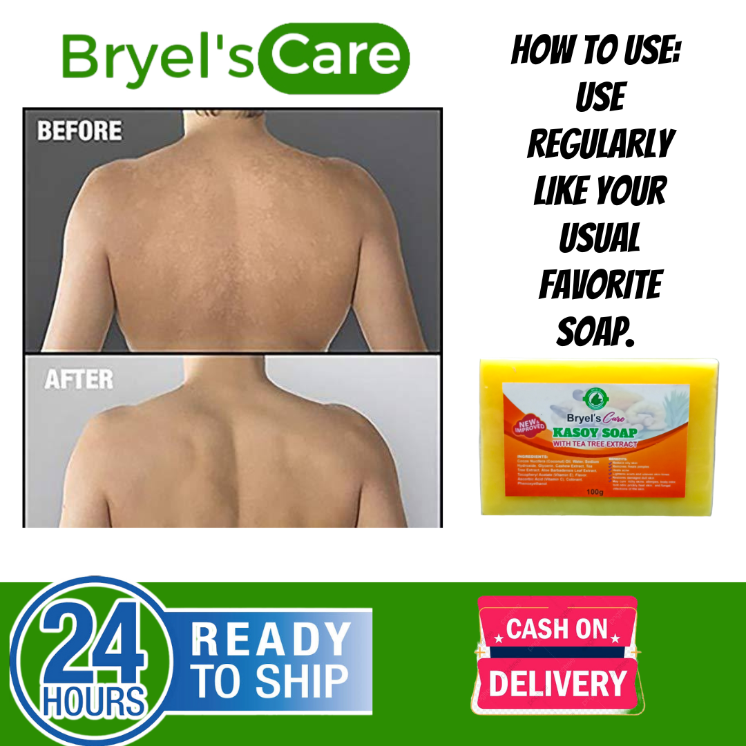 ⚡BRYELS CARE KASOY SOAP for HEAL/REMOVE Pimple Remover, RINGWORM(BUNI ...