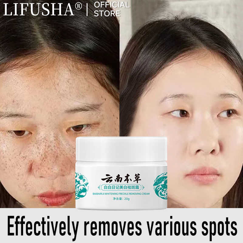 20g Japanese Melasma Cream Melasma Cream From Japan Yunnan Herbal ...