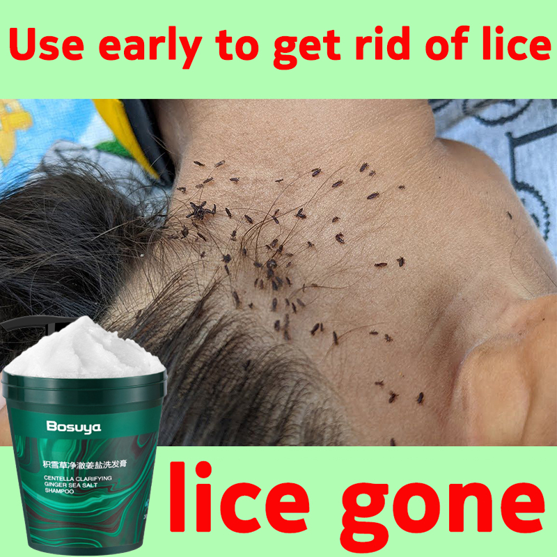 【Quick results in 5 minutes】lice removal shampoo for kids free shower ...