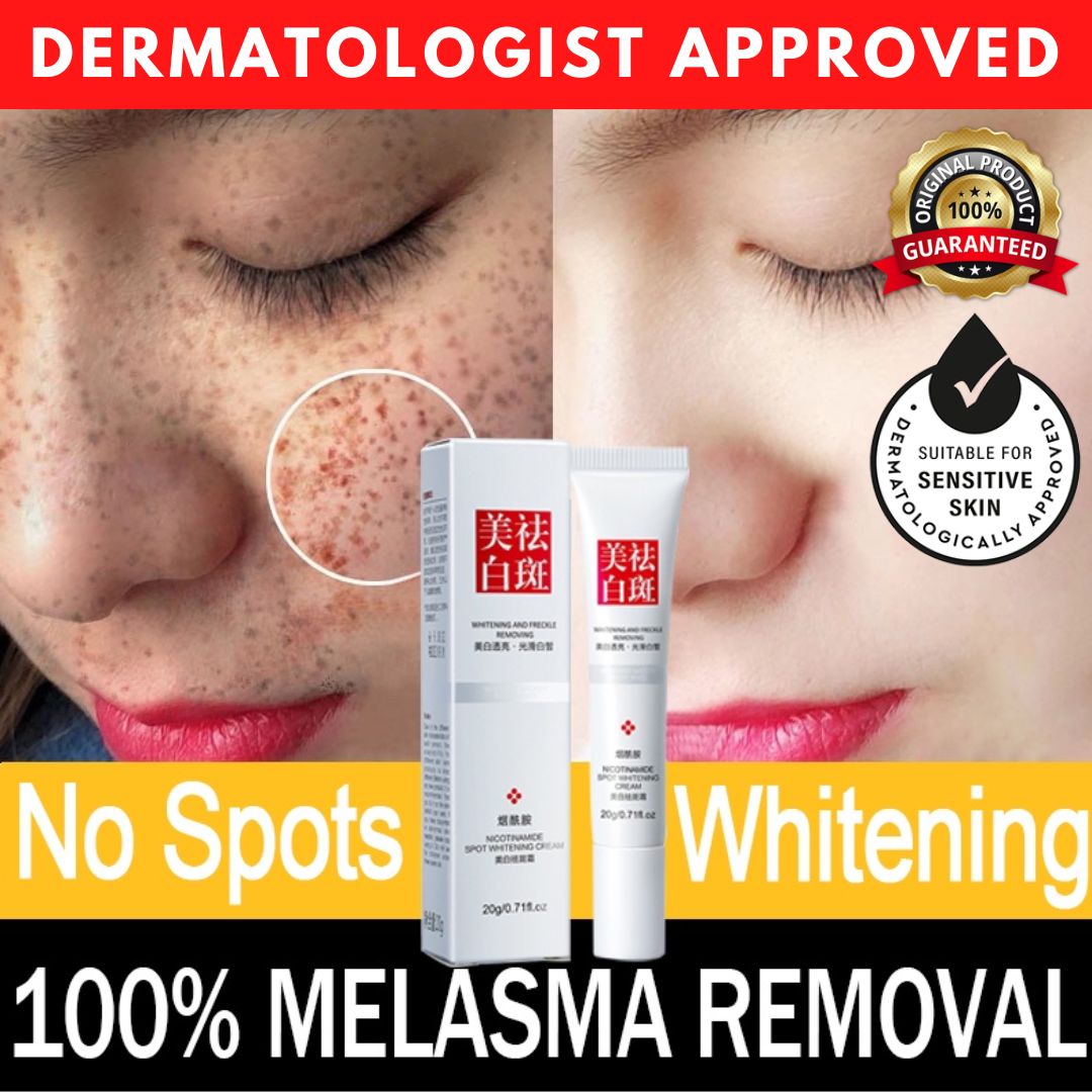 ⭐ ORIGINAL Whitening Freckle Cream Pekas Cream Melasma Remover Cream ...