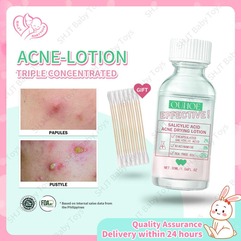 Salicylic Acid Acne Drying Lotion - With Salicylic Acid & Niacinamide ...