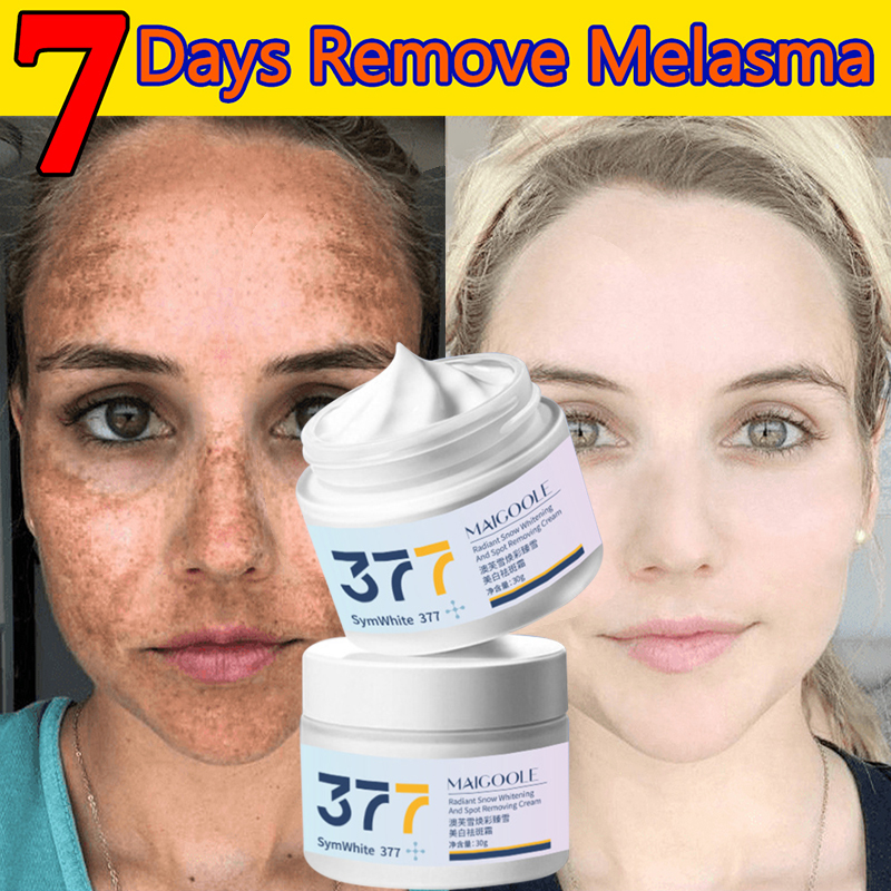 377 whitening cream freckle 30g removing melanin staying up late to ...