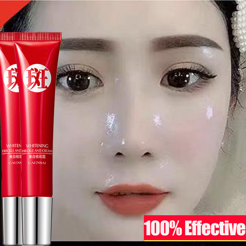 PEKAS REMOVER VERY EFFECTIVE Whitening & Freckle Remover Cream ...