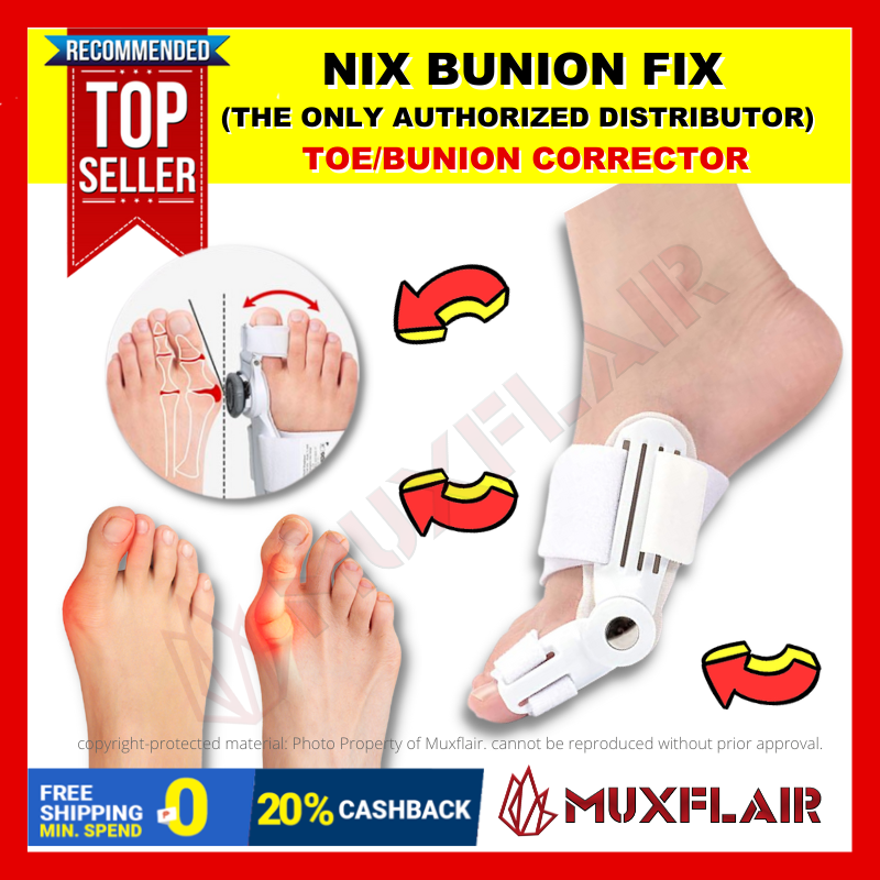 Nix Bunion Fix - Original Toe Corrector For Bunion - Splint Big Toe ...