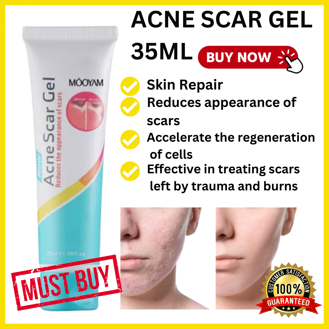 💯ORIGINAL Acne Scar Gel 7g Reduces the appearance of scars 🦋 Finale ...