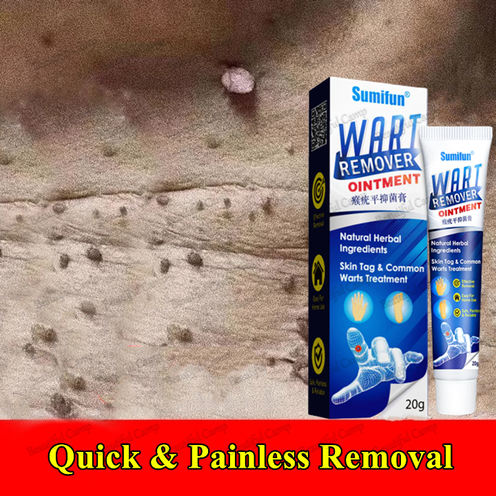 【SUMIFUN】Warts Remover Original Cream Warts Magic Remover Wartz Removal ...