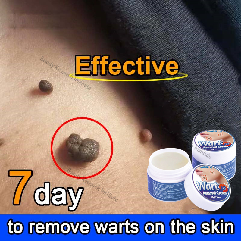 Original Wart Removal Cream Fast Remove Skin Tag Remover Ointment ...