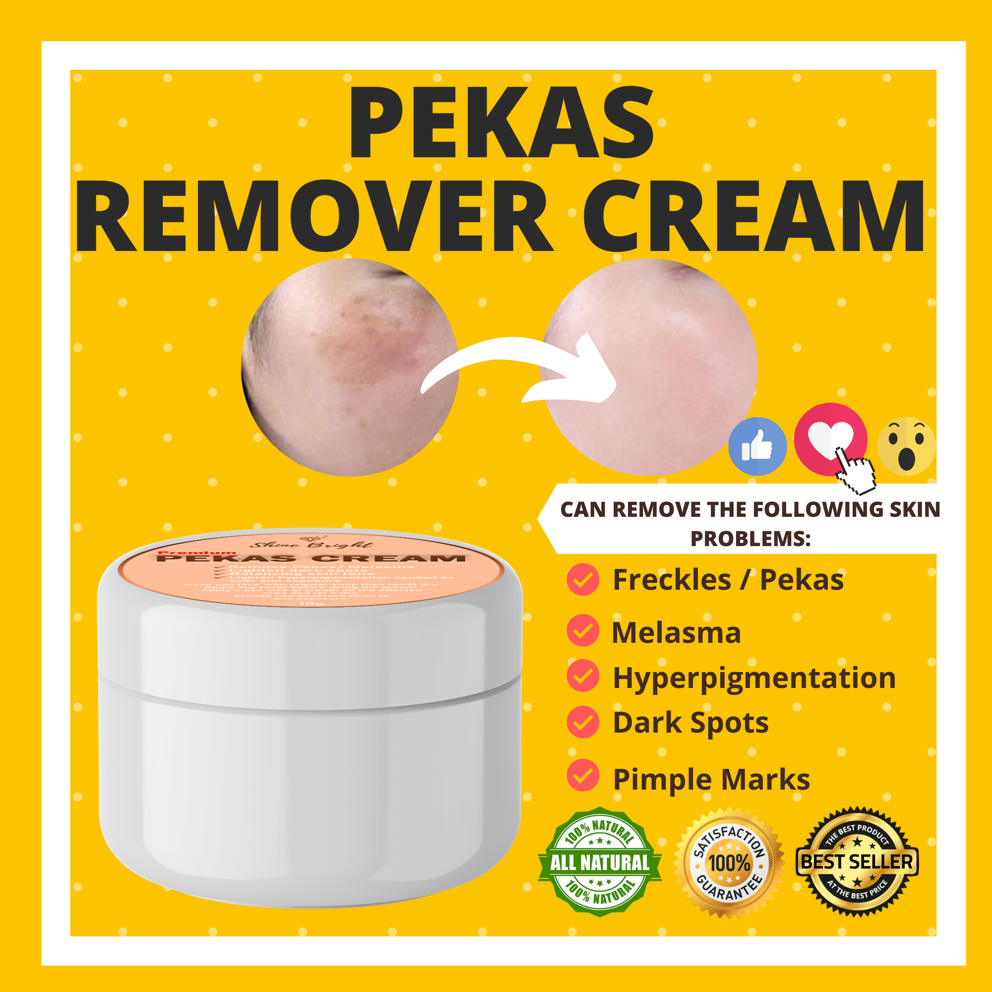 freckle remover cream by Shine Bright freckles remover cream / freckles ...