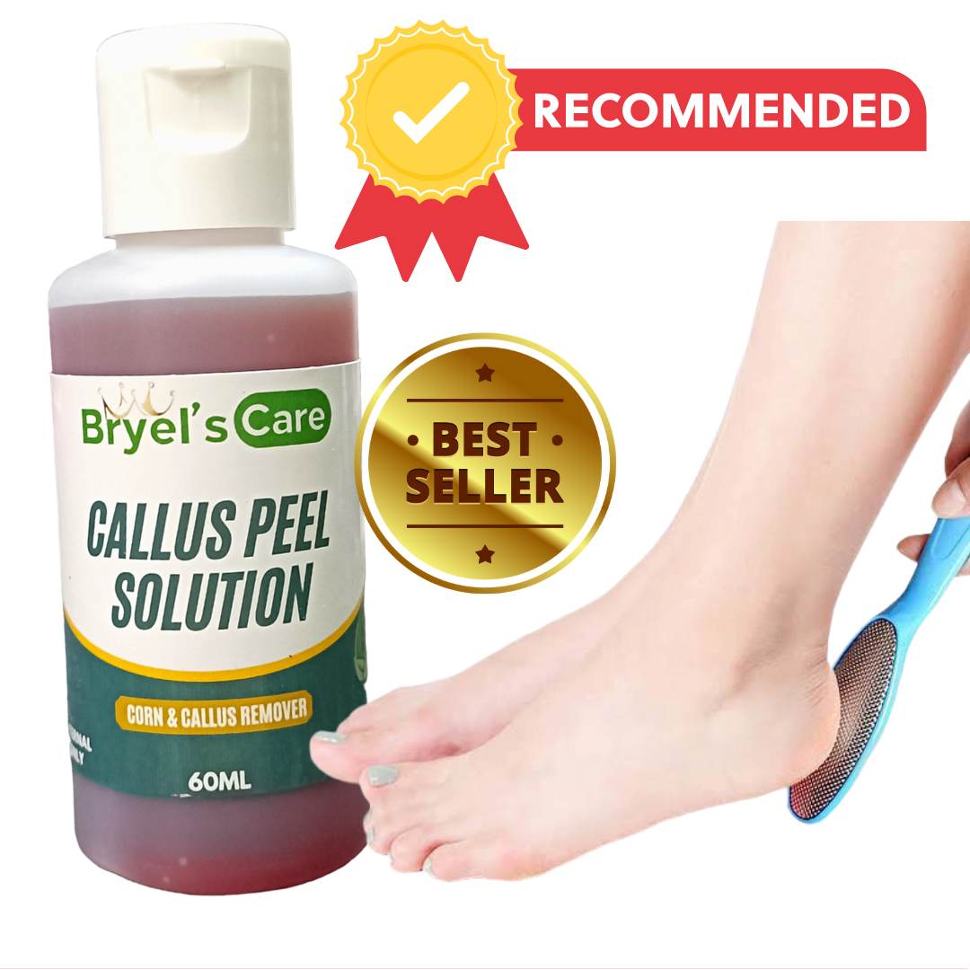 🔥 60ML CALLUS PEEL HAND AND FOOT SOLUTION/Callus Peel RemovER /Callus Peel Solution FOR FOOT AND ...