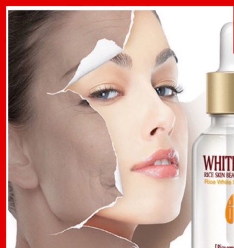 Authentic ROREC White Rice Serum Reduces Wrinkles Dark Spots | Lazada PH