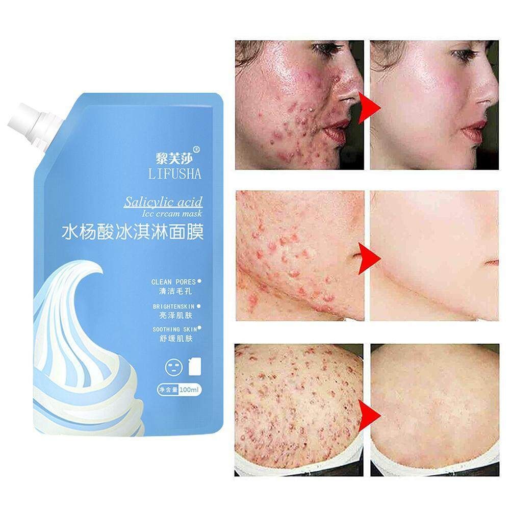 Salicylic Acid Ice Cream Face Mask Facial Mask For Remove Acne ...