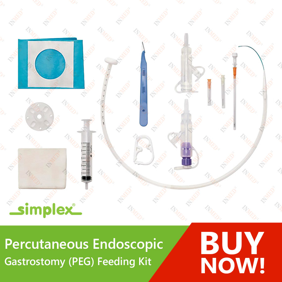 Simplex Percutaneous Endoscopic Gastrostomy (PEG) Feeding Kit | Lazada PH