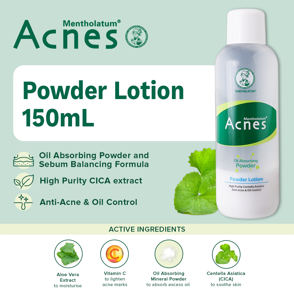 Acnes Powder Lotion 150ml | Lazada PH
