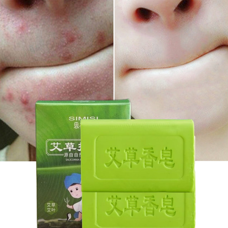 Anti Acne Anti Mites Soap Moisturizing Whitening Face and Body Soap For ...