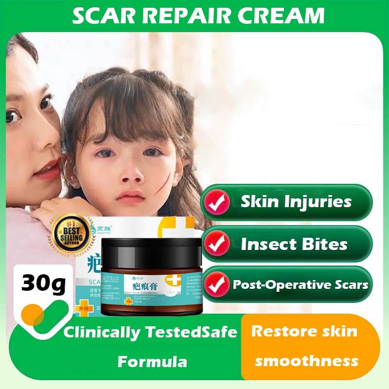 Fade old and new scars restore smooth skin scar remover cream 30g Can ...