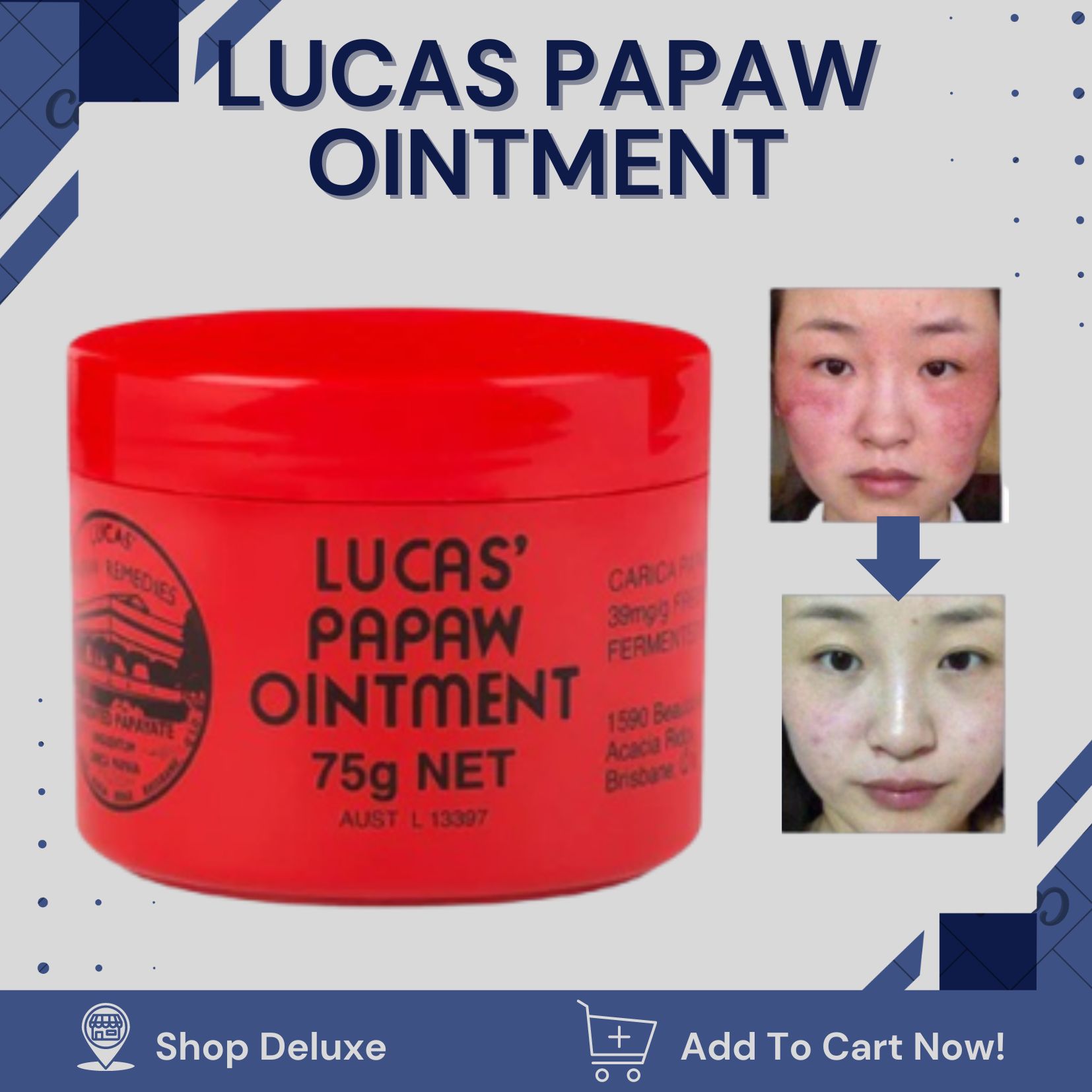 LUCAS PAPAW OINTMENT 75g | Lazada PH