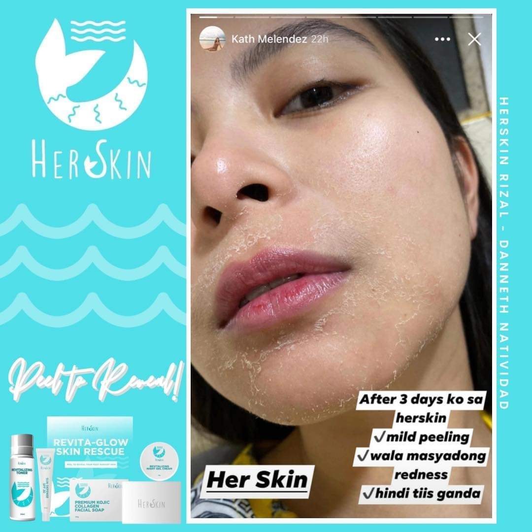HERSKIN Revita Glow Skin Rescue Kit | Beauty Skincare Acne Treatment ...